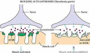 Score osserman | Rea ICU