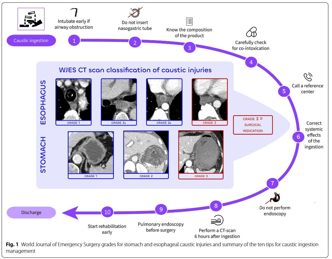 10 étapes pour la prise en charge des ingestions caustiques chez l ...